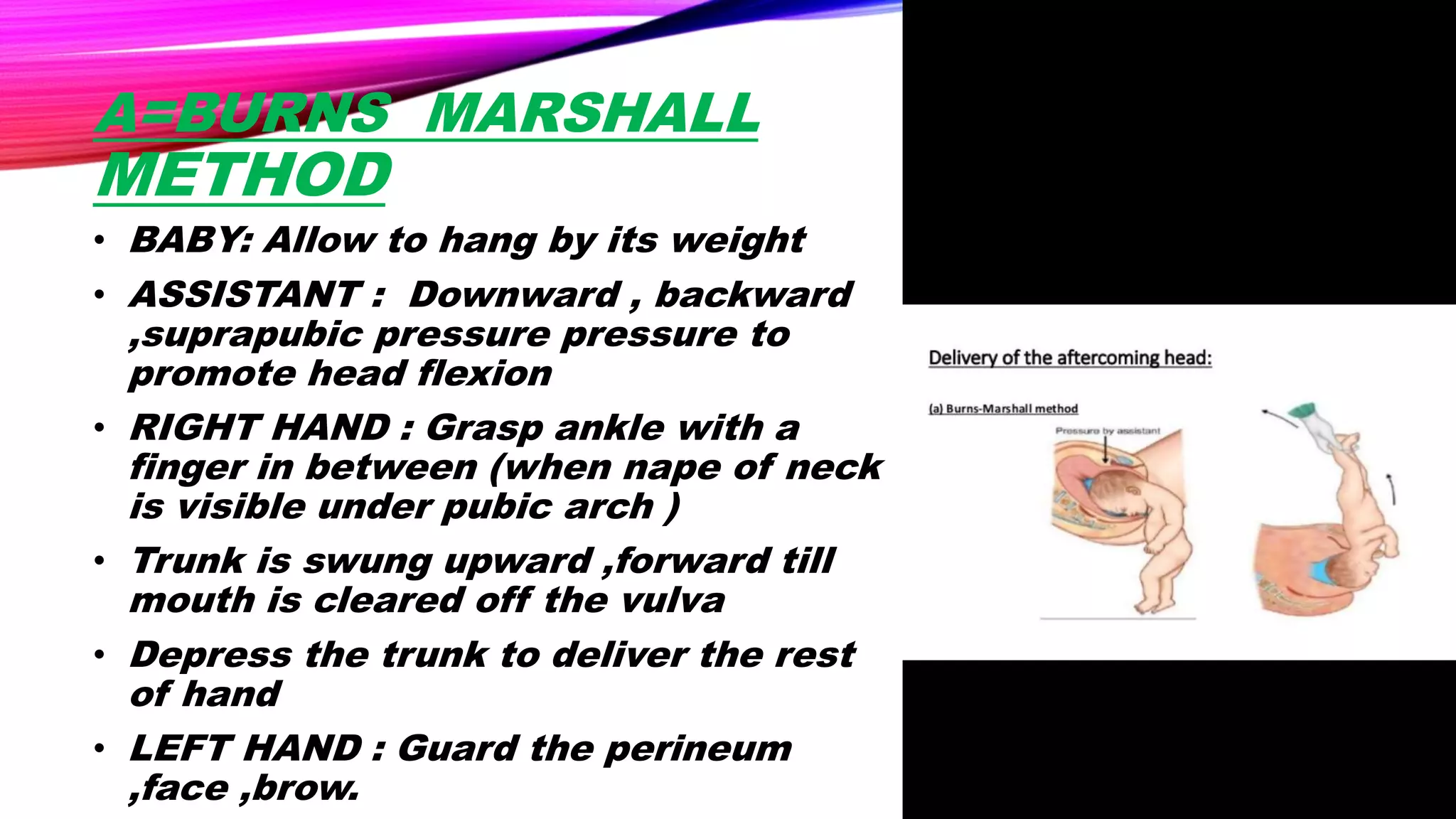 breech presentation | PPTX