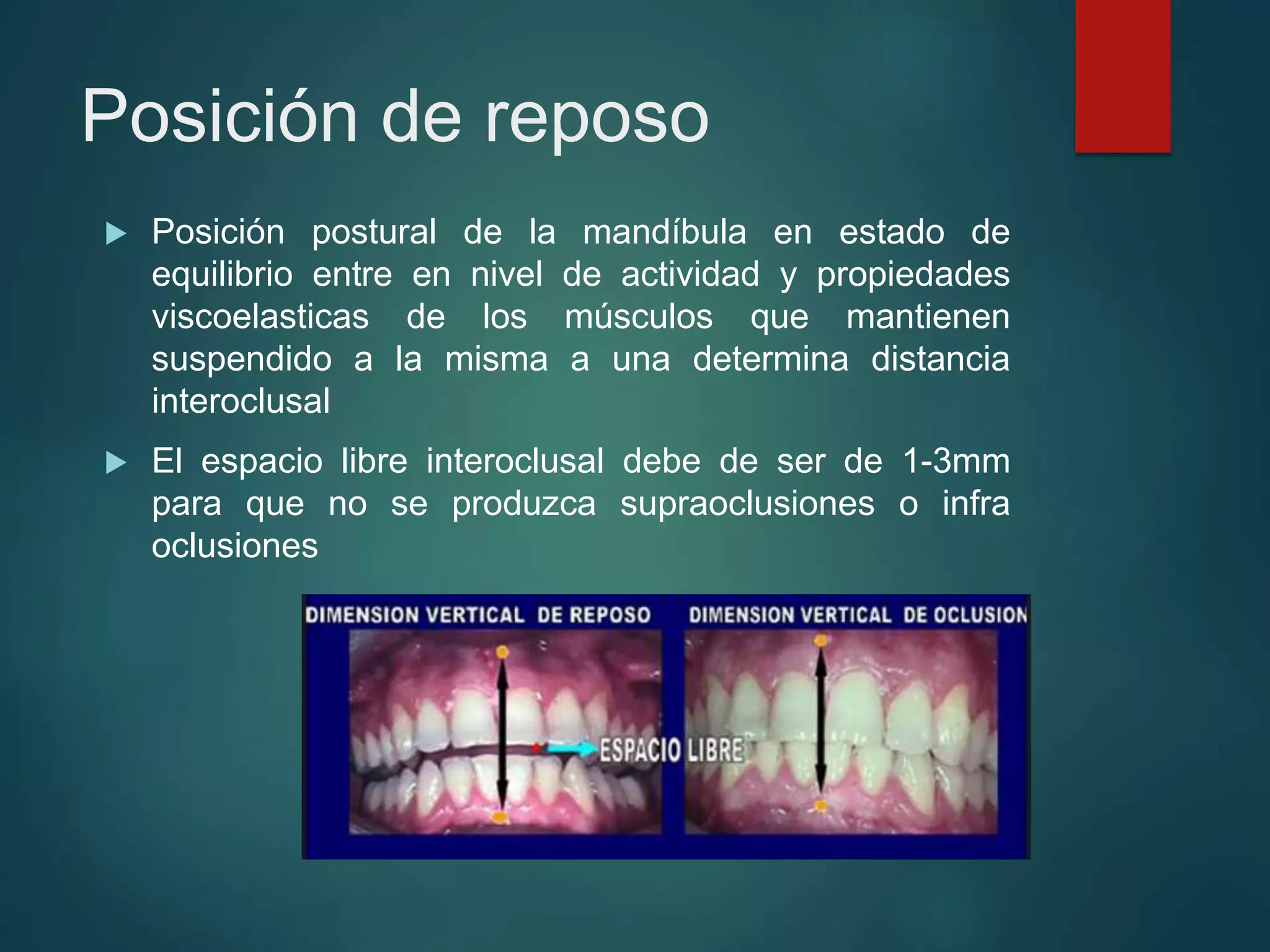 Relaciones intermaxilares y relación molar y canina [recuperado] | PPTX