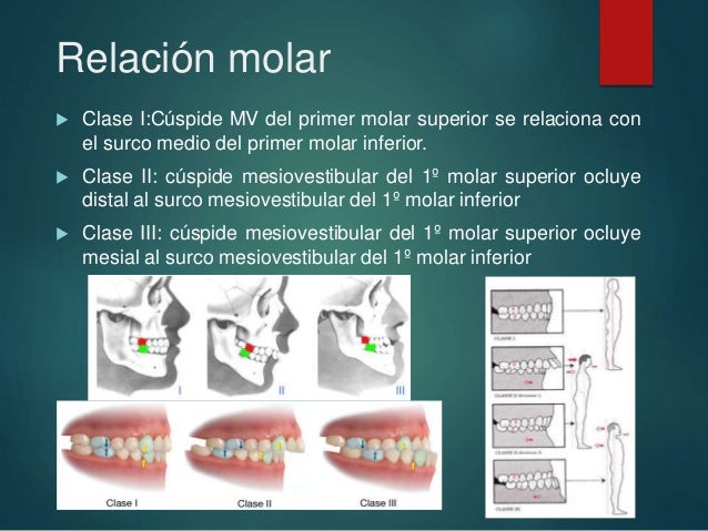 Relaciones intermaxilares y relación molar y canina [recuperado]