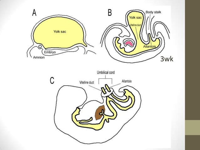 Related umbilical disorders | PPTX