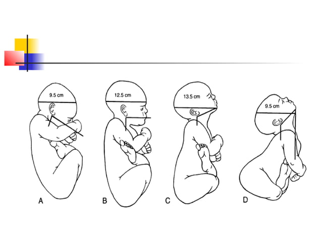 Relation between fetus & pelvis | PPT