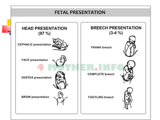 Relation between fetus & pelvis | PPT