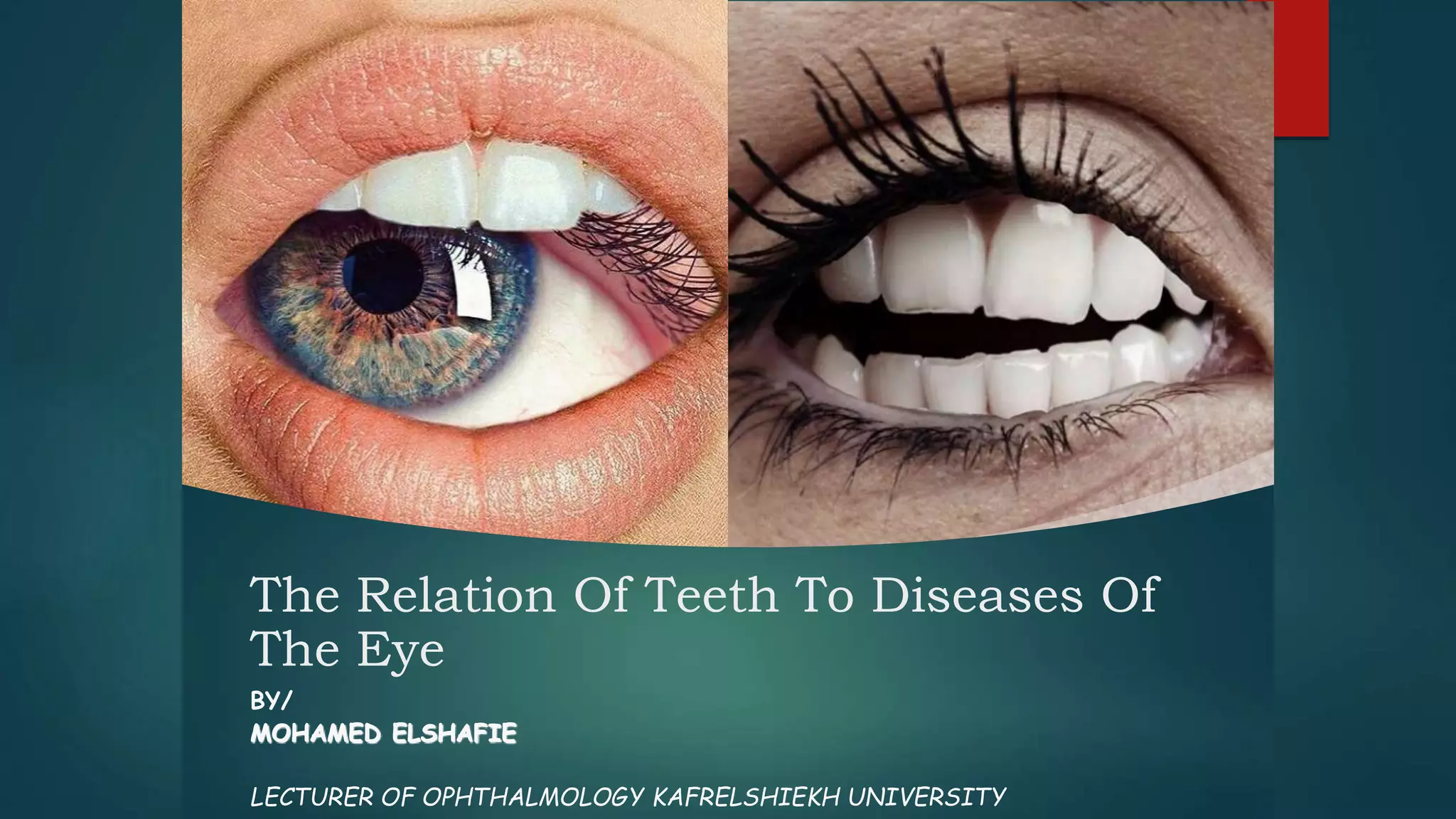 Relation between teeth and eye.pptx | Eye and Vision Conditions ...