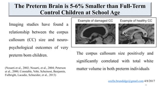 Relationship between brain volume maturation and gestational age | PPT