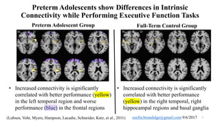 Relationship between prematurity and executive function | PPT