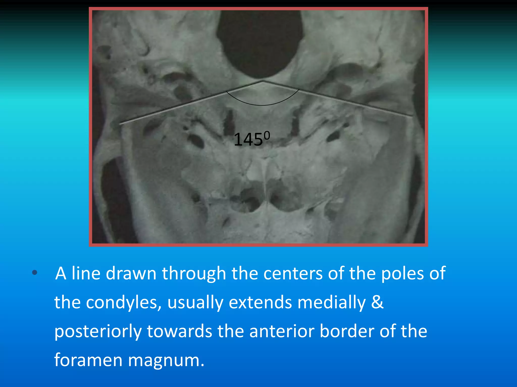 Relationship of tmj anatomy and pathology and related | PPTX
