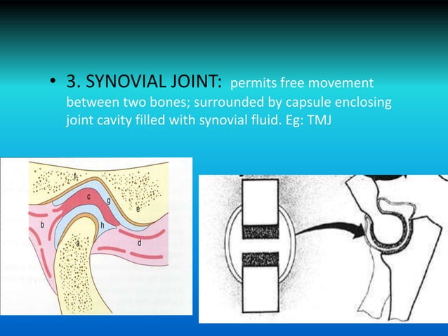 Relationship Of Tmj Anatomy And Pathology And Related Pptx