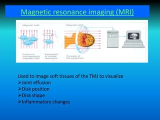 Relationship of tmj anatomy and pathology and related | PPTX