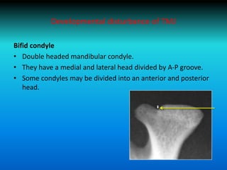 Relationship of tmj anatomy and pathology and related | PPTX