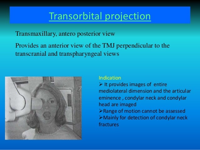 Relationship of tmj anatomy and pathology and related