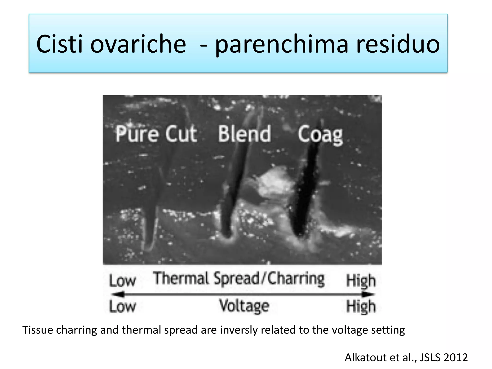Relazione cisti ovariche pro laparotomia | PPTX