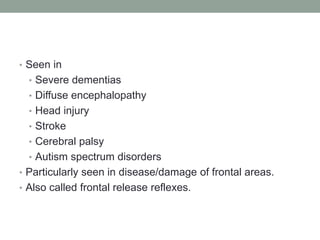 Release reflexes | PPTX