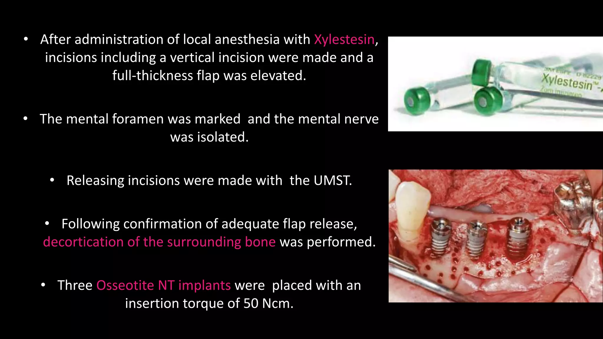 Releasing Incisions Using Upward-Motion Scissors Technique for Flap ...