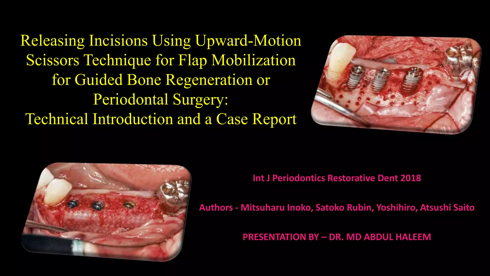 Releasing Incisions Using Upward-Motion Scissors Technique for Flap ...