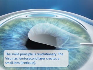 Re l ex smile, the future of refractive surgery - medifocus sept 2013 ...