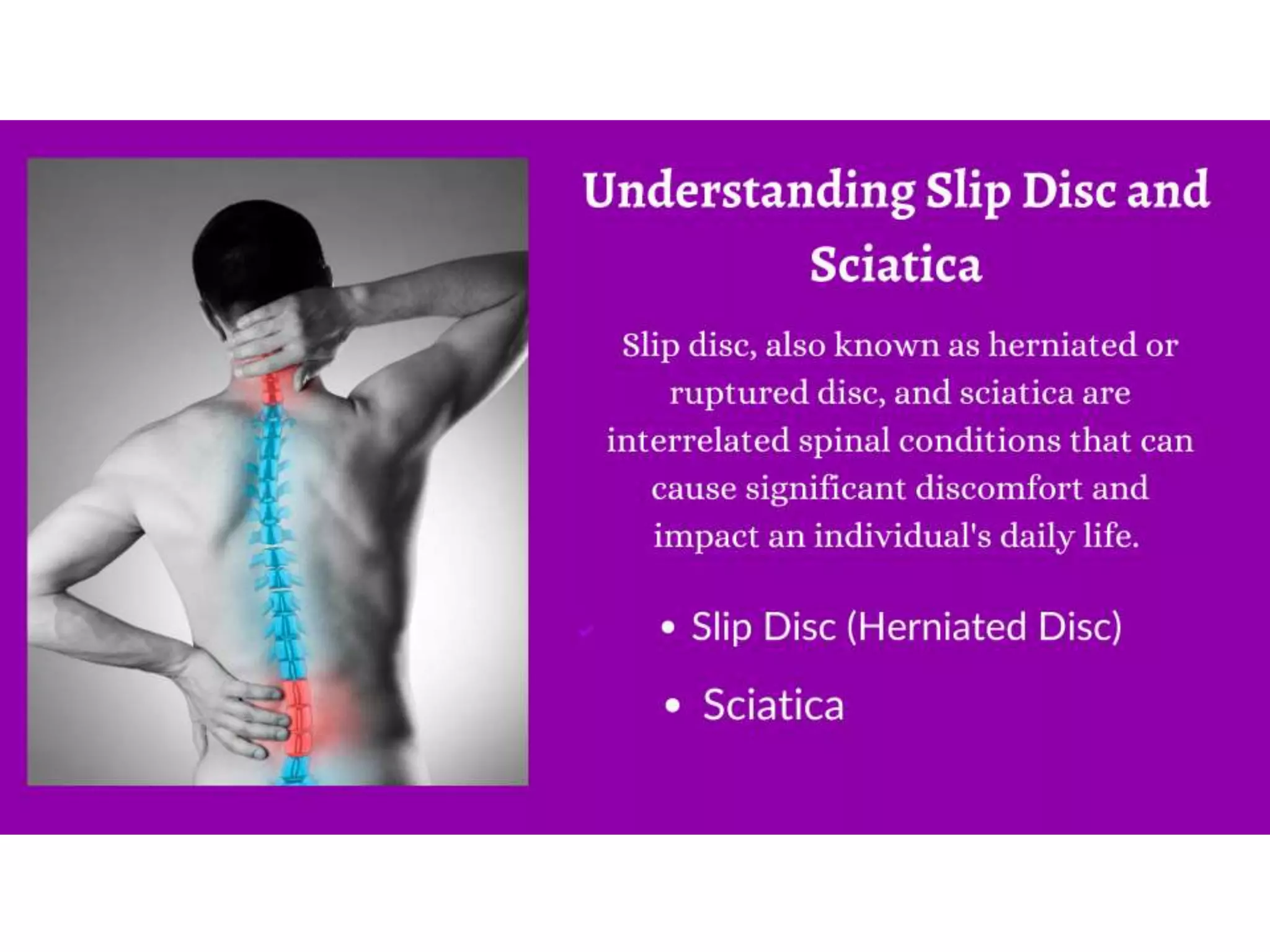 Relief and Recovery Spine Care Techniques for Slip Disc and Sciatica.pptx