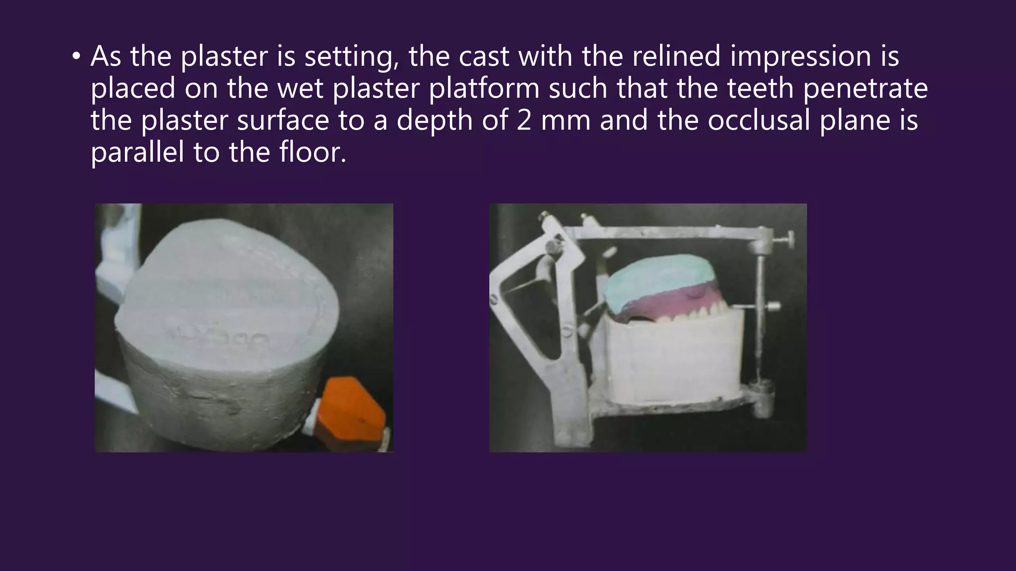 Relining and rebasing | PPTX