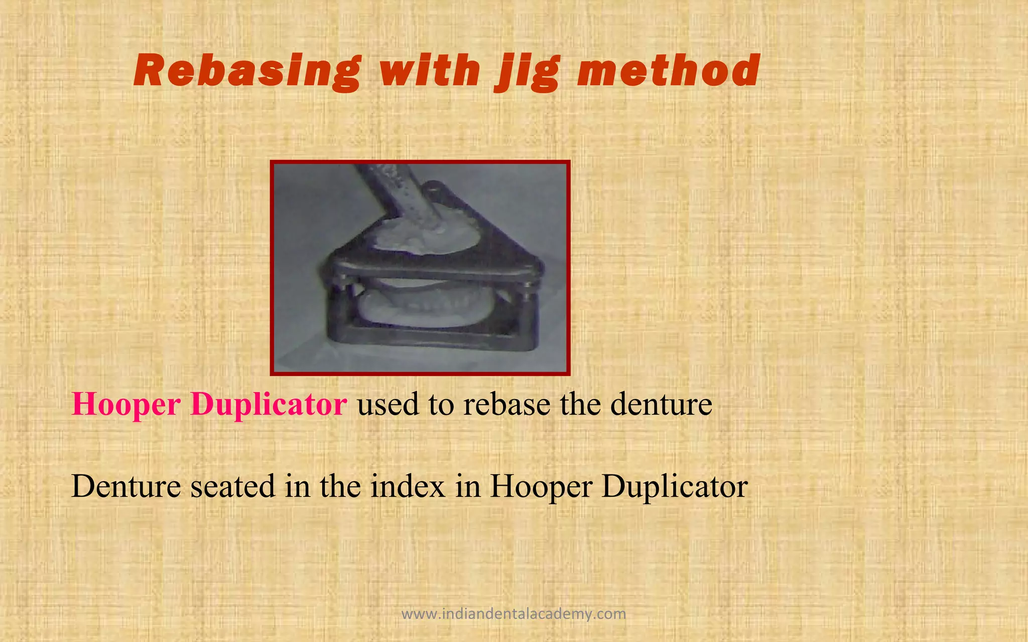 Relining and rebasing in complete dentures / Labial orthodontics ...