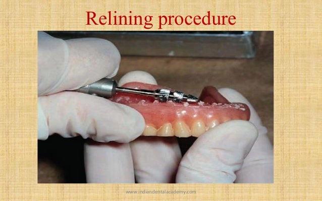 Relining and rebasing in complete dentures / Labial orthodontics cour…