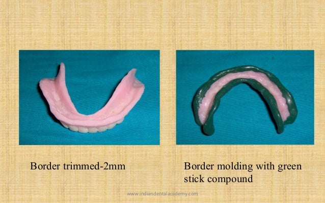 Relining and rebasing in complete dentures / Labial orthodontics cour…