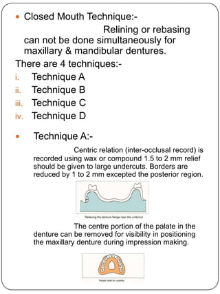 Relining and rebasing in cd | PPTX