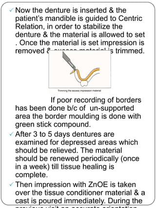 Relining and rebasing in cd | PPTX
