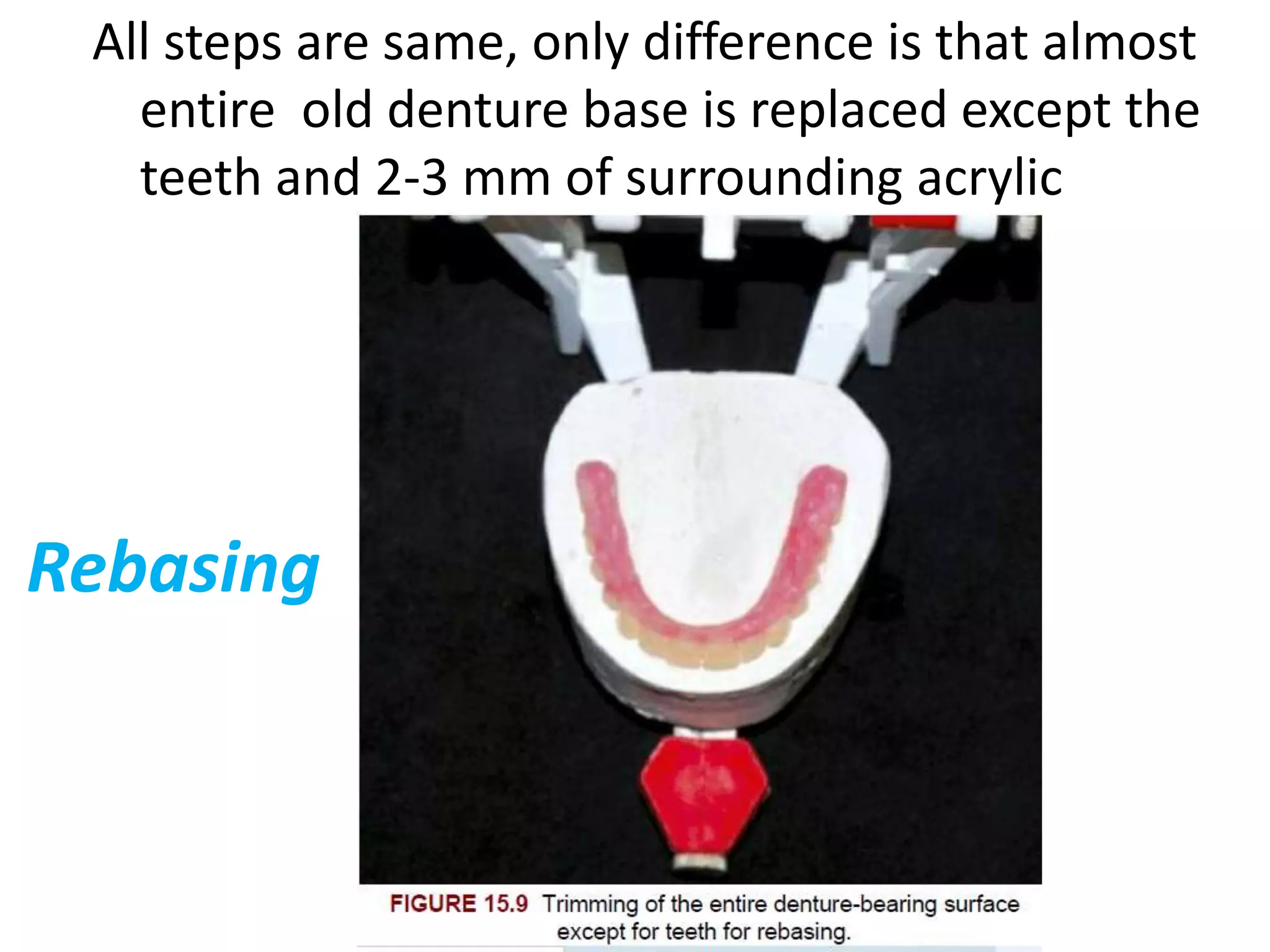 Relining and rebasing in complete dentures | PPTX