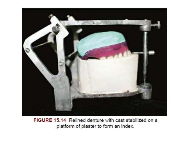 Relining and rebasing in complete dentures | PPTX | Dental Health ...