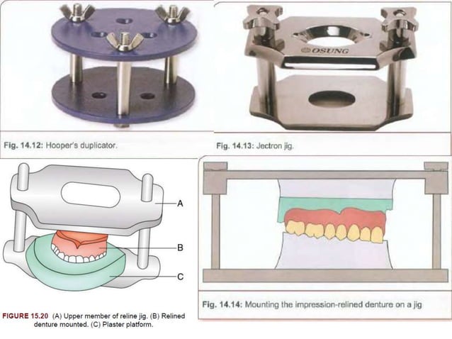 Relining and rebasing in complete dentures | PPTX | Dental Health ...
