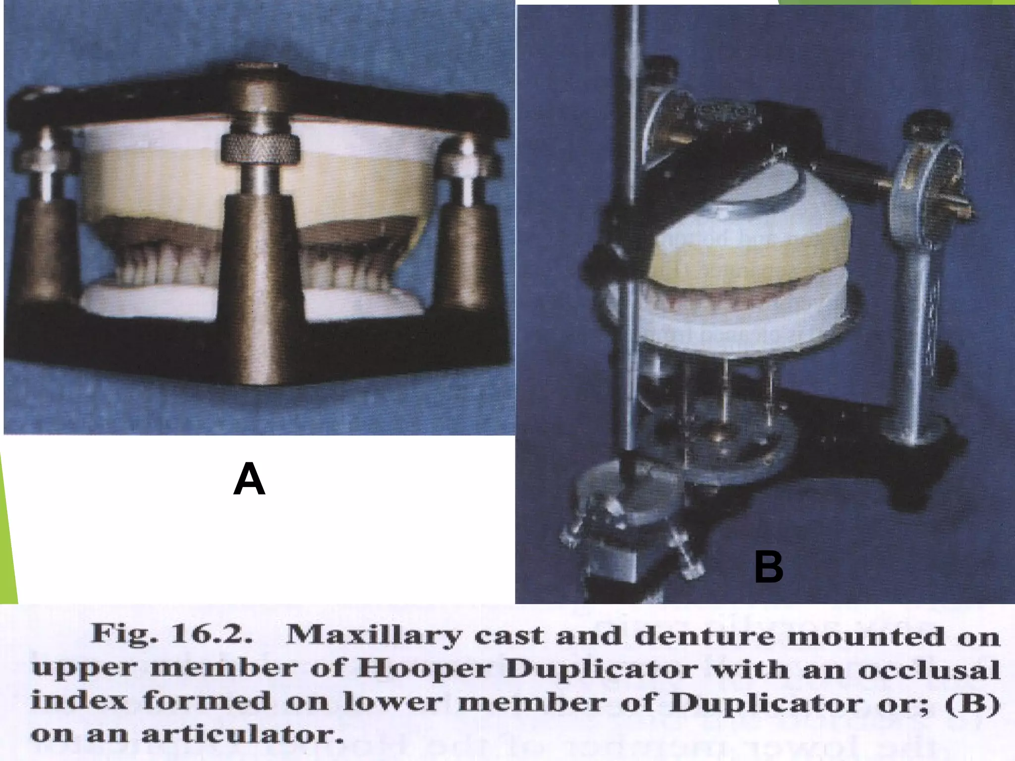 Relining and rebasing of complete dentures | PPT