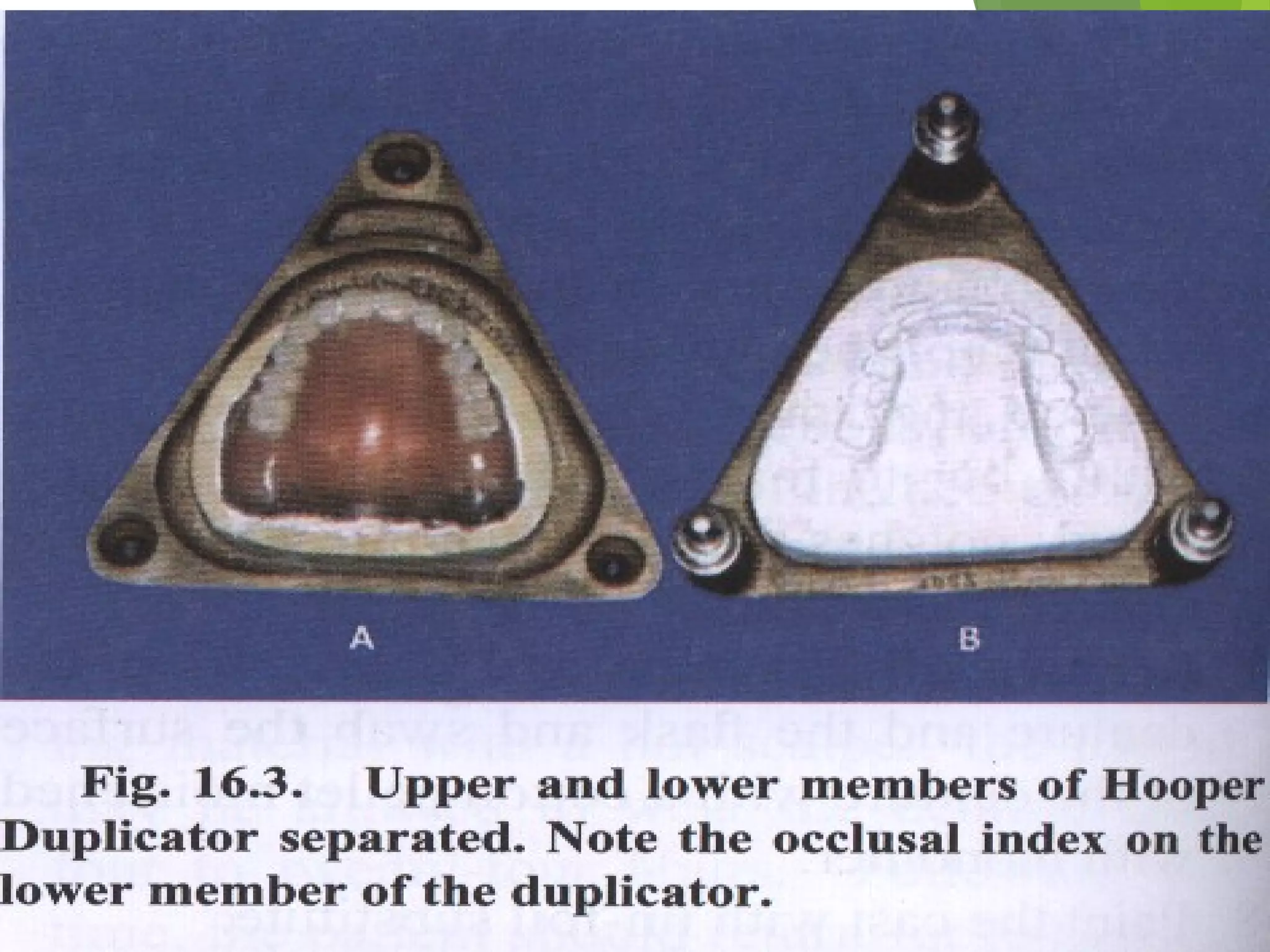 Relining and rebasing of complete dentures | PPT