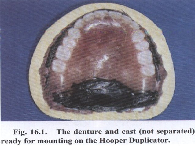 Relining and rebasing of complete dentures | PPT