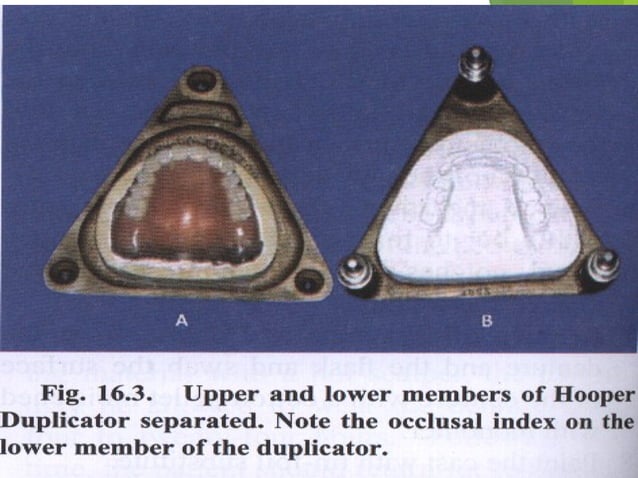 Relining and rebasing of complete dentures | PPT