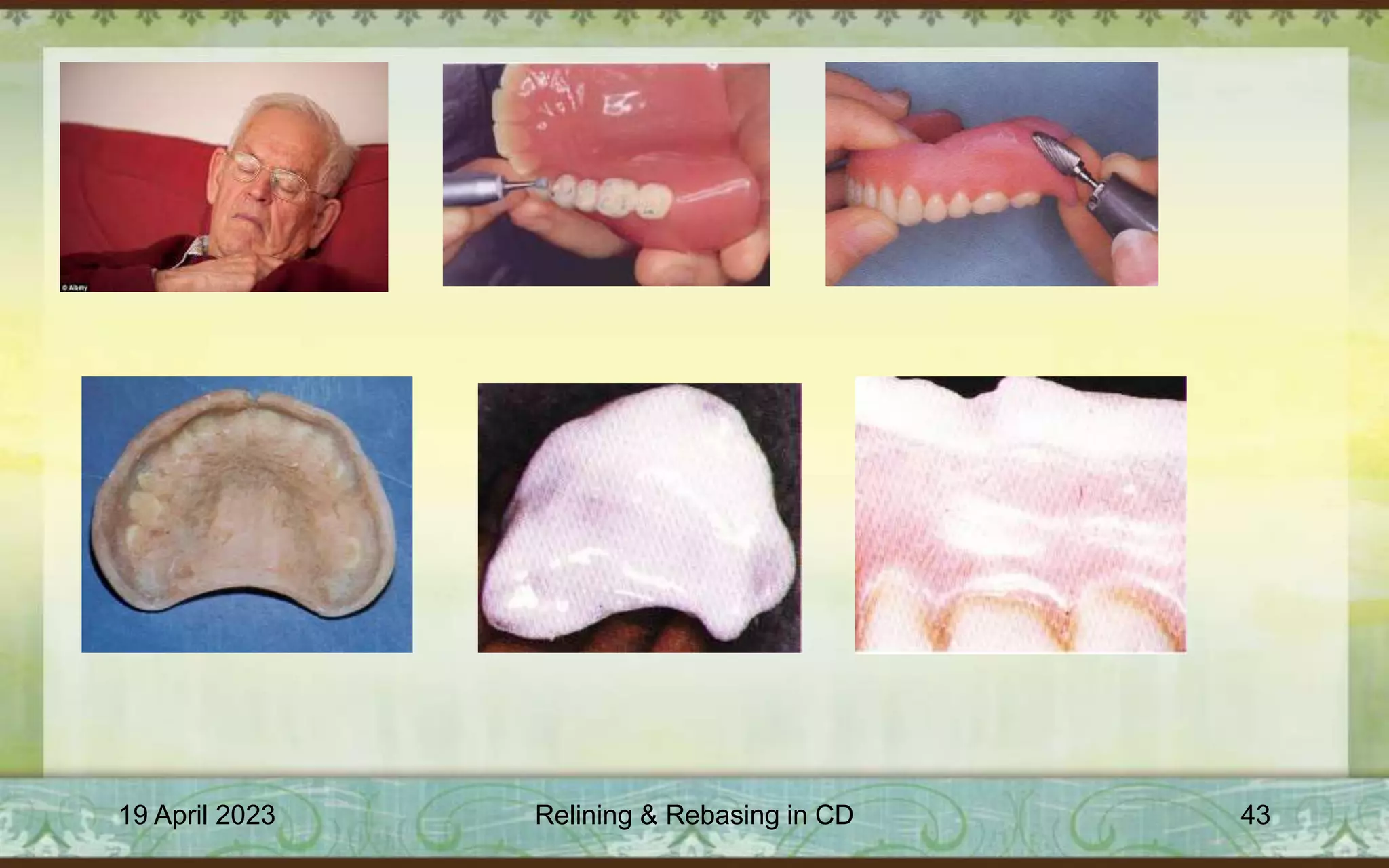 Relining & Rebasing in CD.pptx