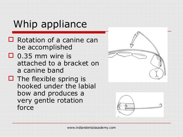 Rem app two /certified fixed orthodontic courses by Indian dental aca…