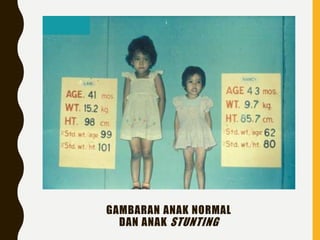 Materi Rembuk Stunting untuk perbaikan gizi.pptx