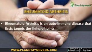 Remedies to get rid off arthritis | PPT