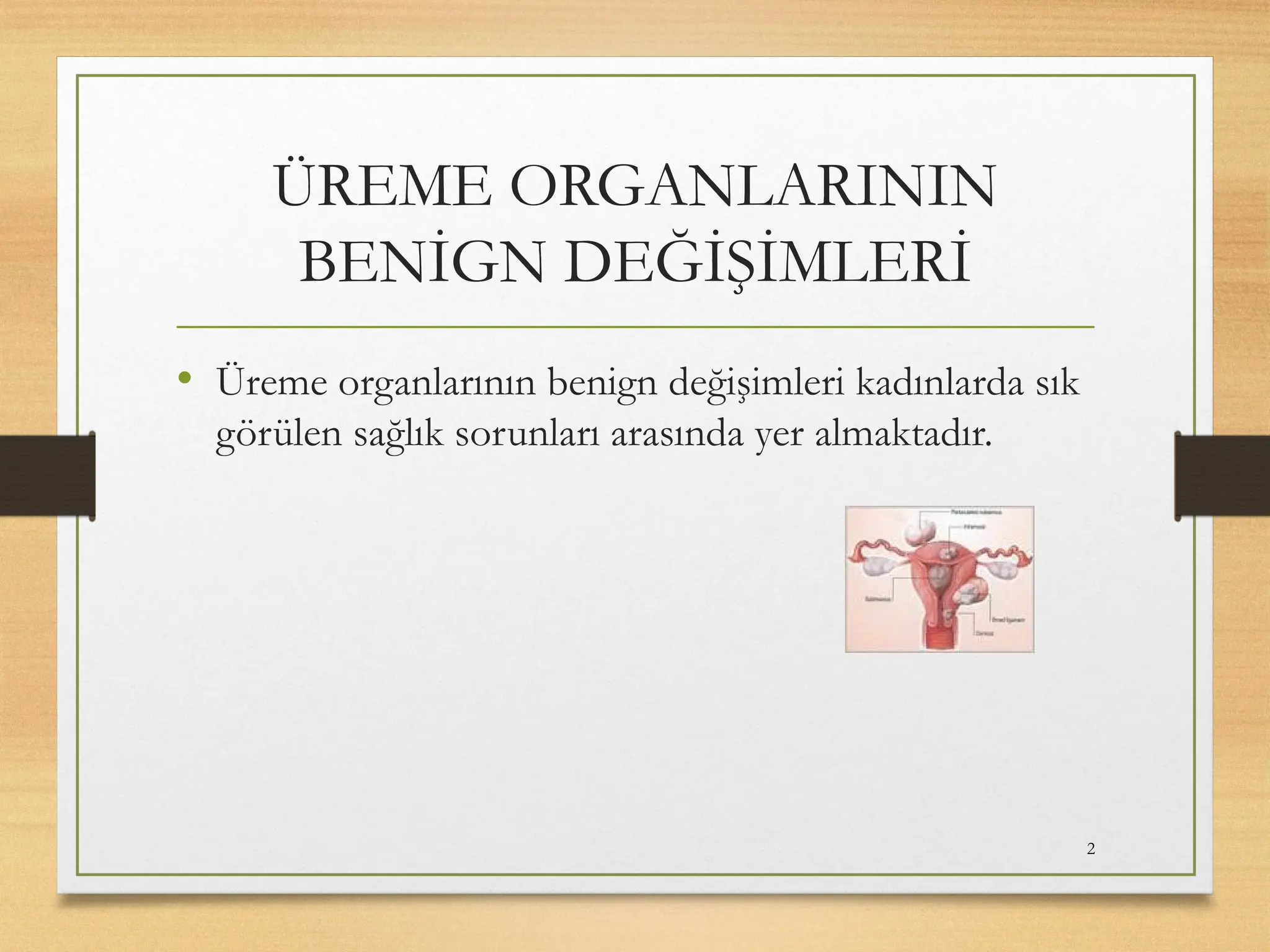 ÜREME ORGANLARININ BENİGN DEĞİŞİMLERİ.ppt