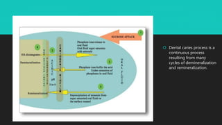 Remineralization agents in dentistry | PPTX