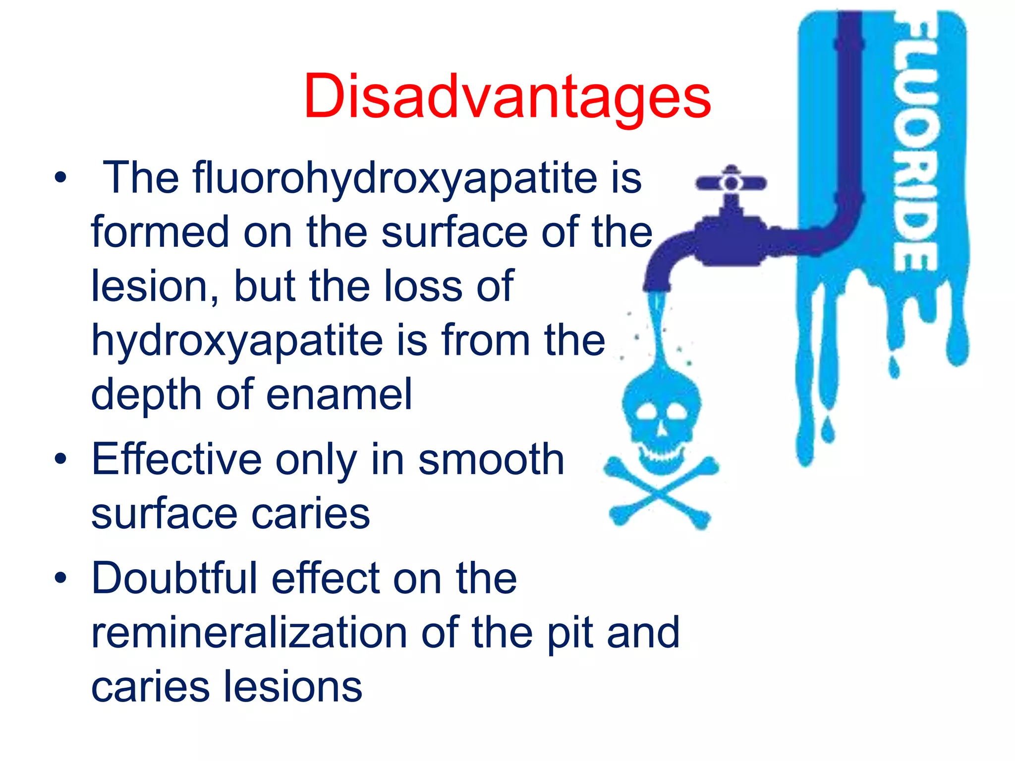 Tooth Remineralizing agents in pediatric dentistry | PPTX