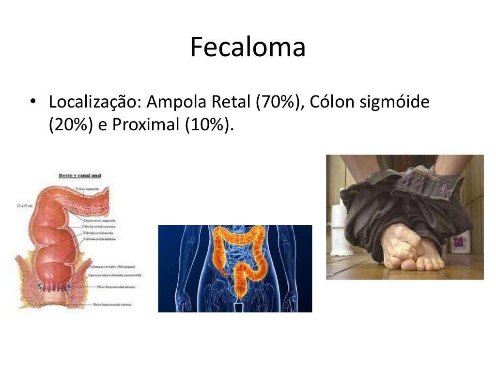 Aula Remoção manual impactação fecal (fecaloma)
