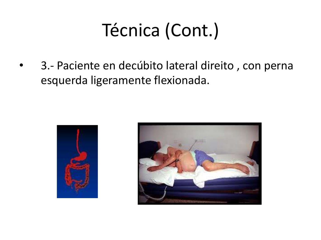 Aula Remoção manual impactação fecal (fecaloma)