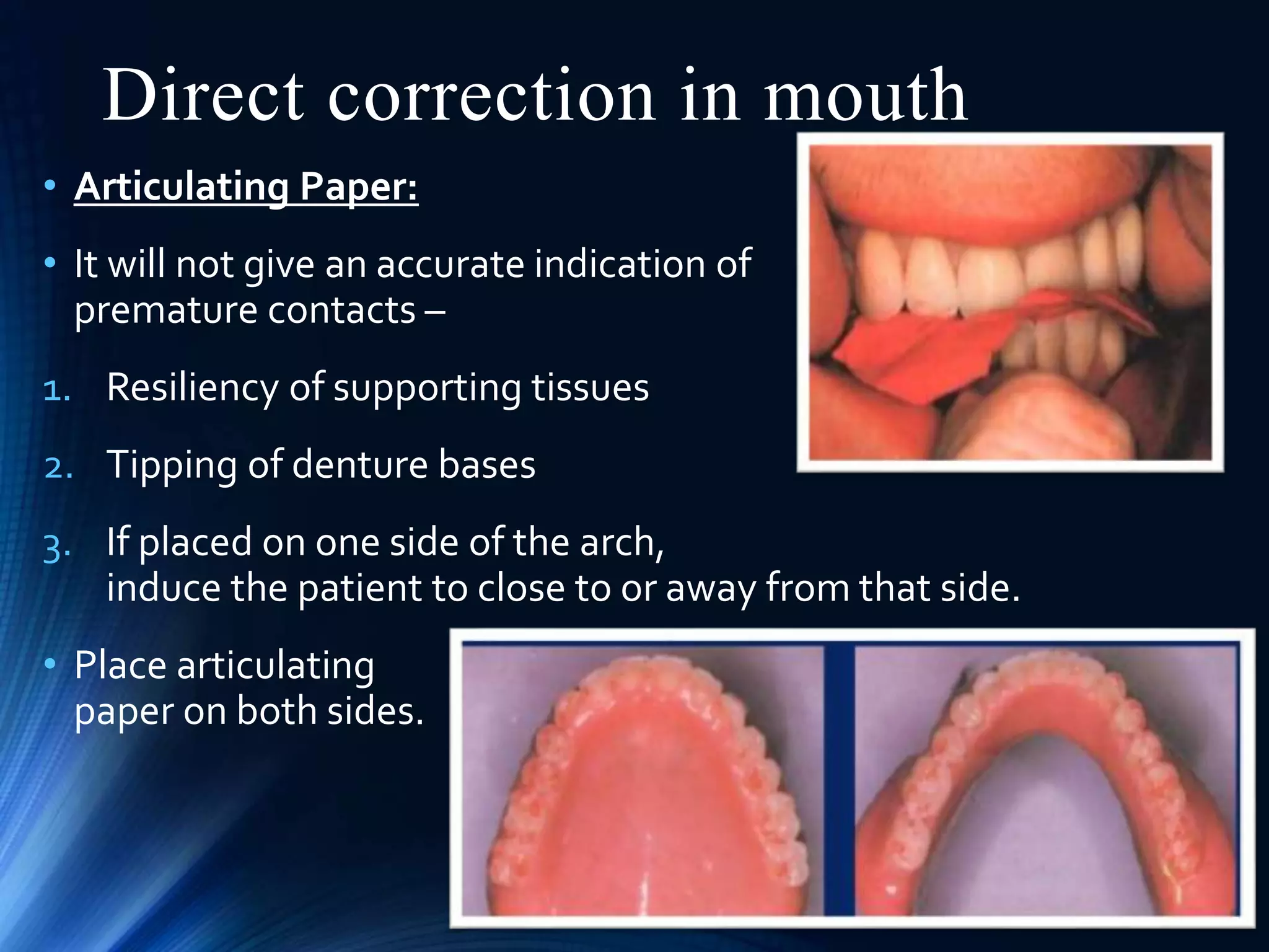 Remounting of complete dentures | PPTX