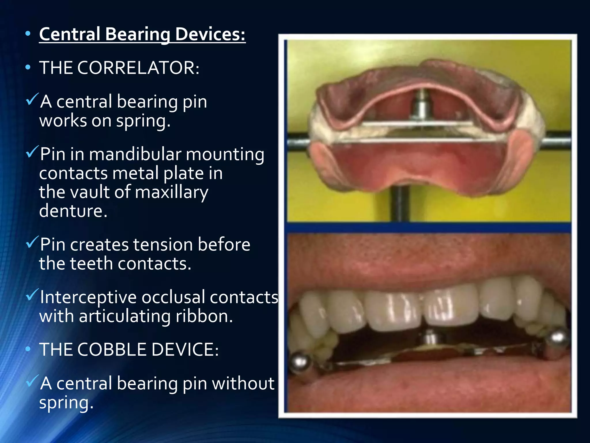 Remounting of complete dentures | PPTX