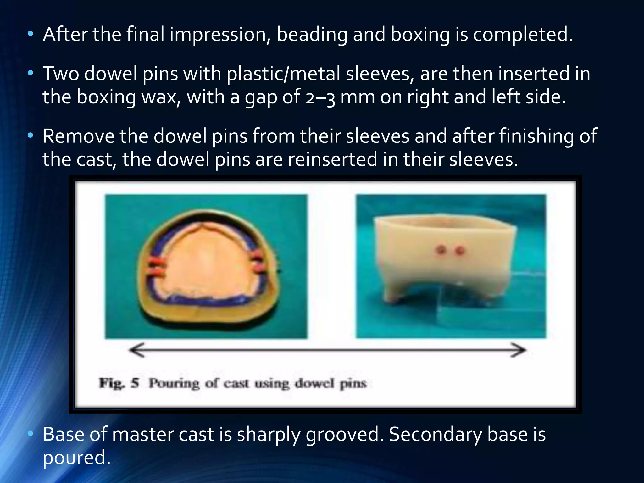 Remounting of complete dentures | PPTX
