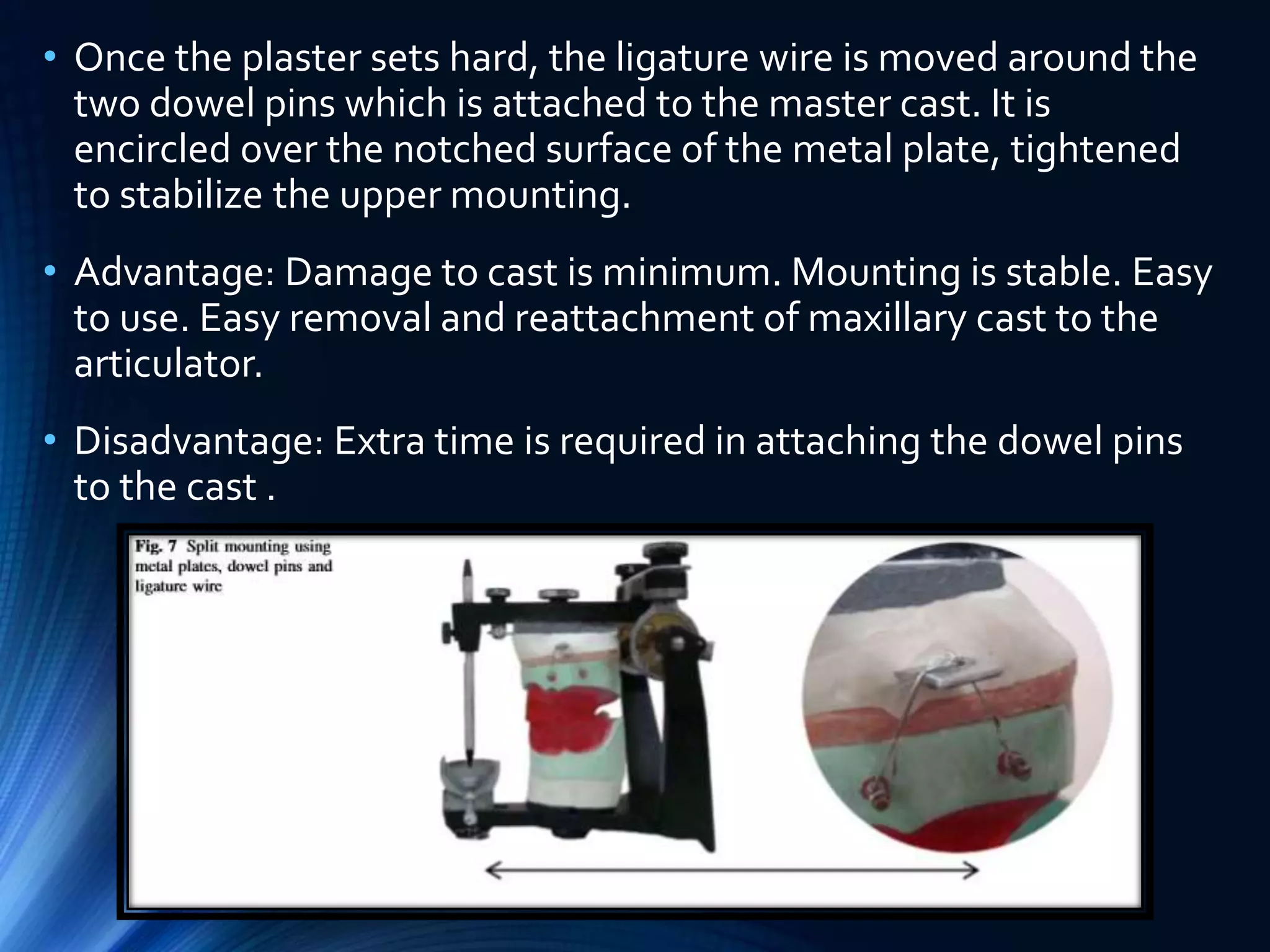 Remounting of complete dentures | PPTX