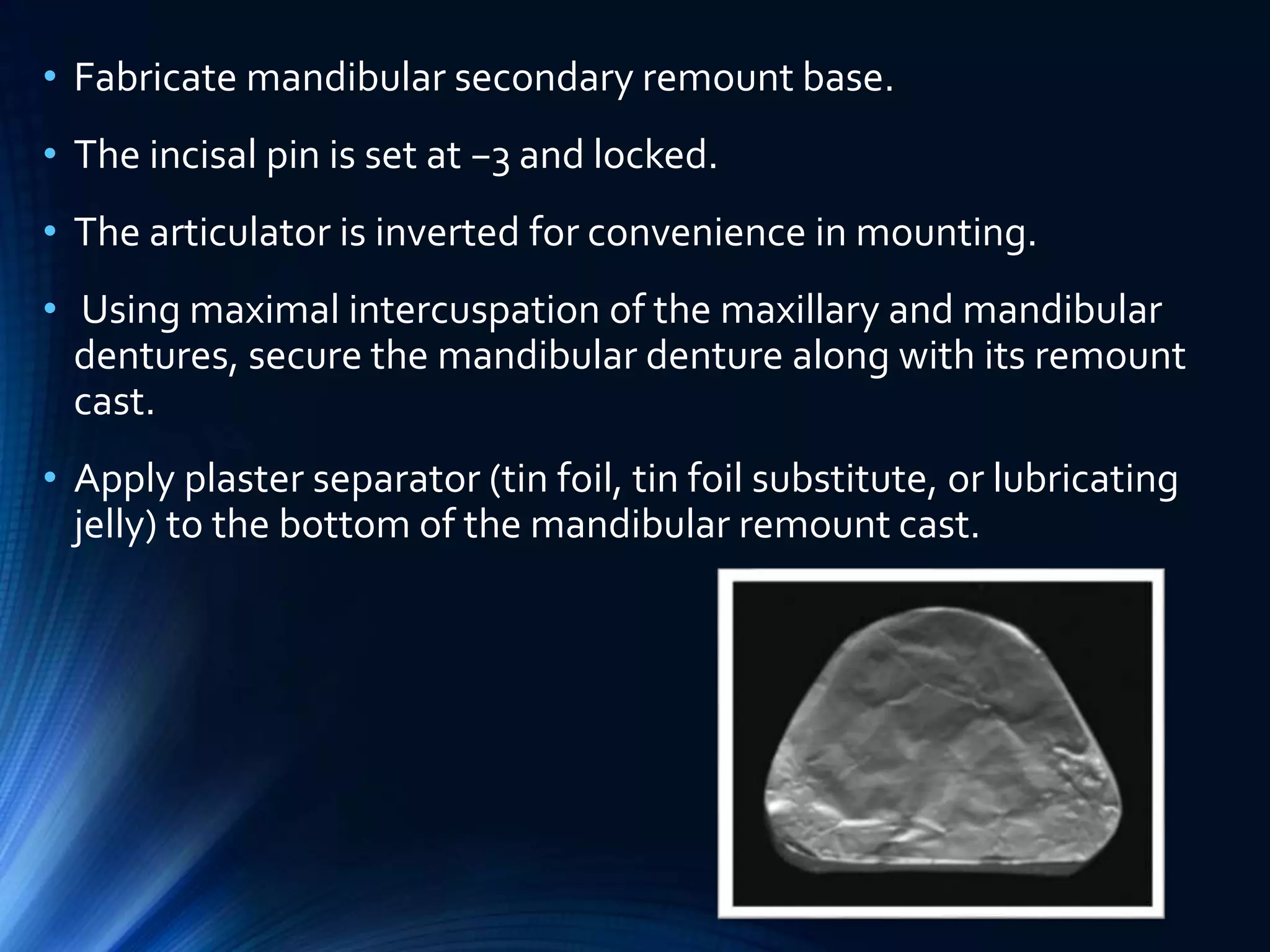 Remounting of complete dentures | PPTX