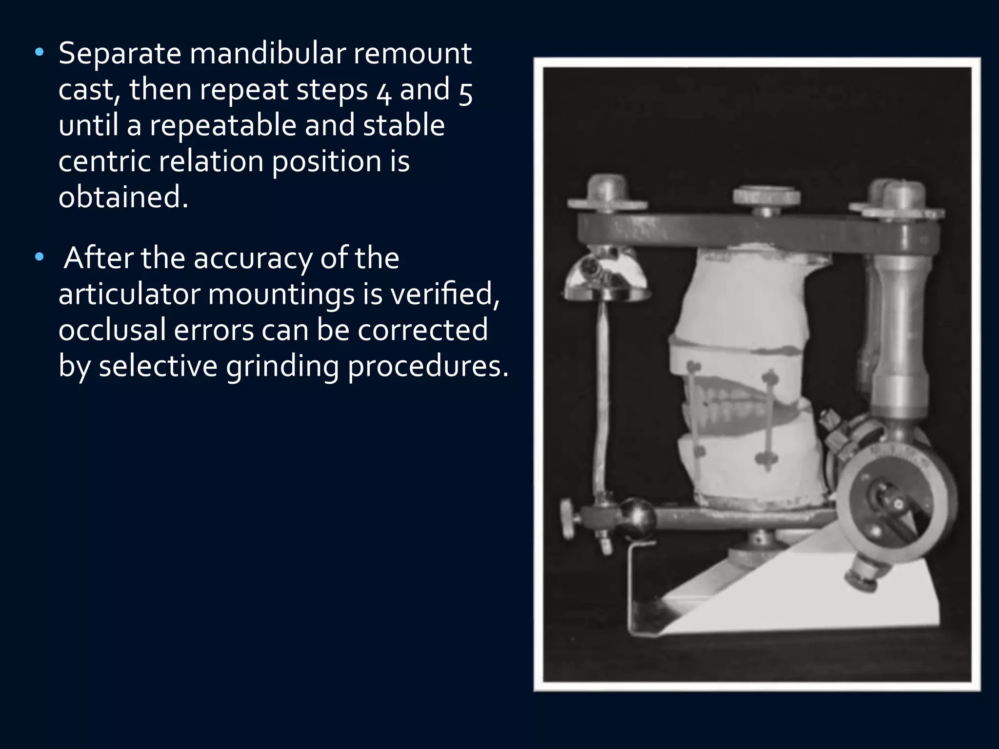 Remounting of complete dentures | PPTX
