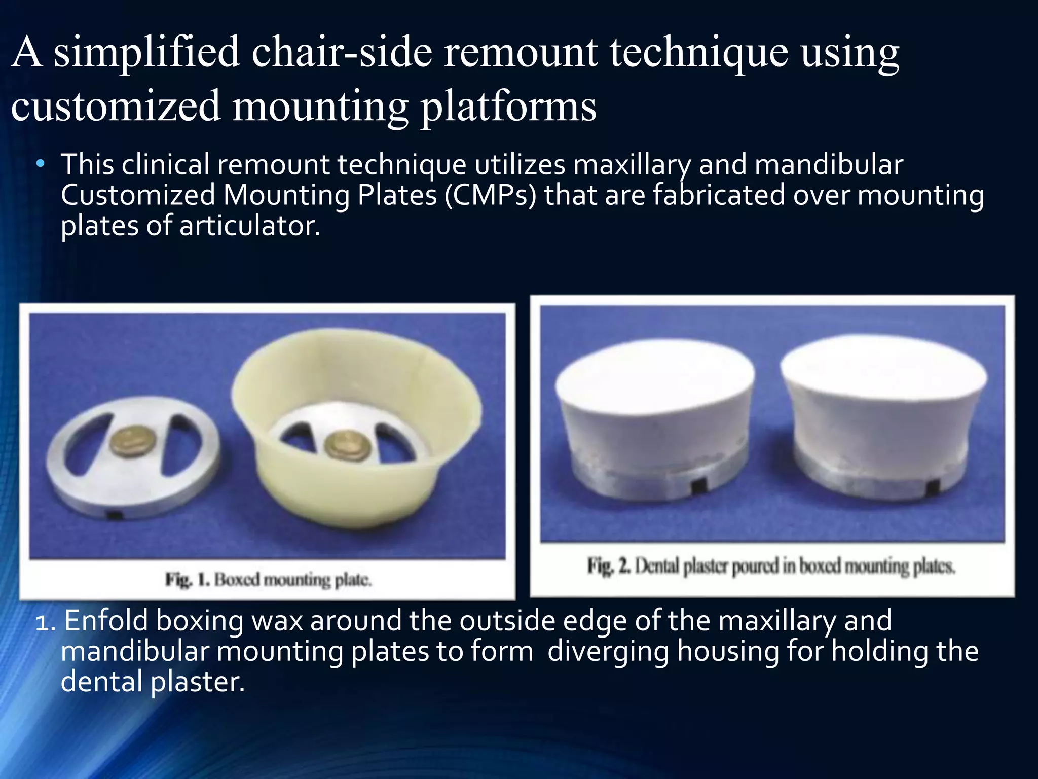Remounting of complete dentures | PPTX