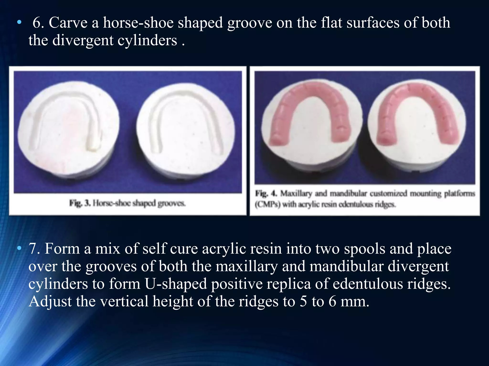 Remounting of complete dentures | PPTX